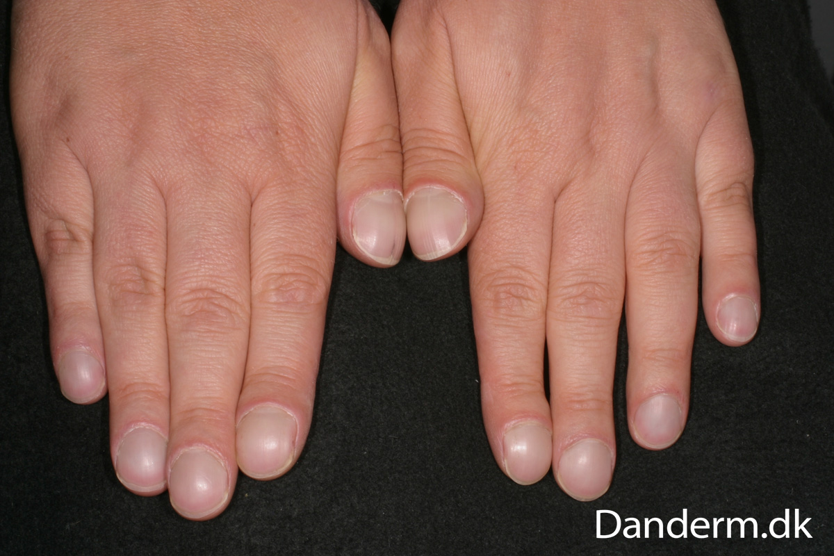 What is the meaning of clubbed together? – Famuse : #1 Models, Actors ...