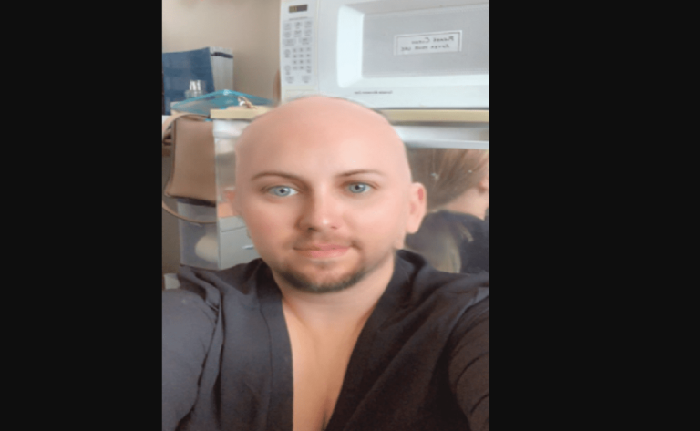 How do you get a bald filter on TikTok? – Famuse : #1 Models, Actors ...